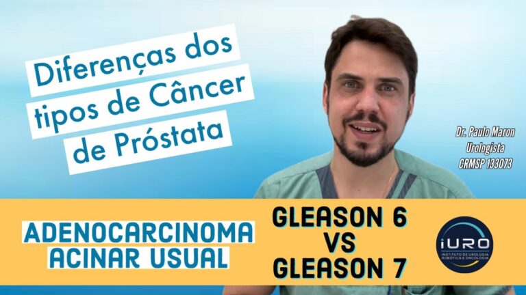 Adenocarcinoma Acinar: Entendendo o Gleason 3+3=6 | Actualizado ...